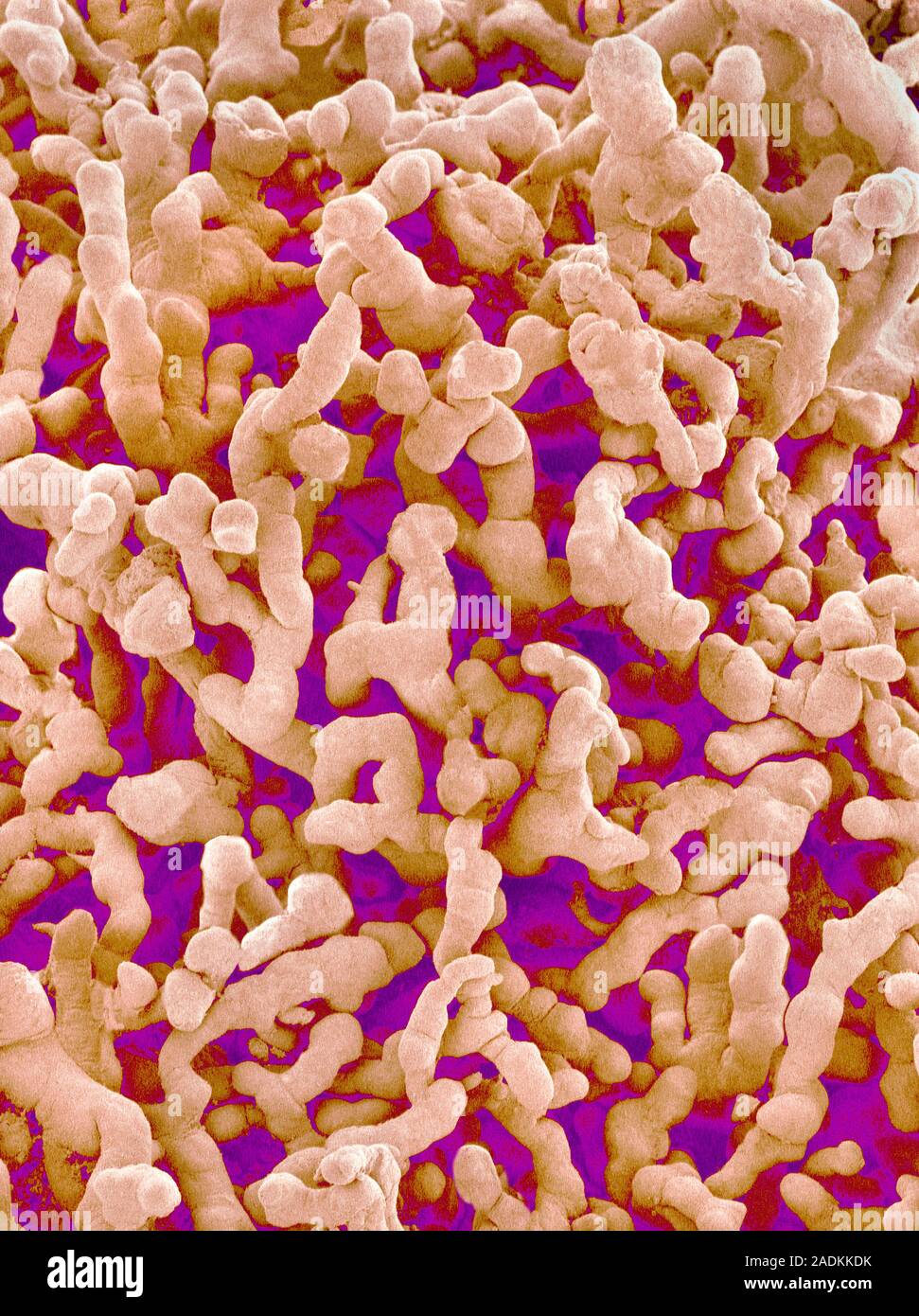 Human placenta. Coloured scanning electron micrograph (SEM) of villi in ...