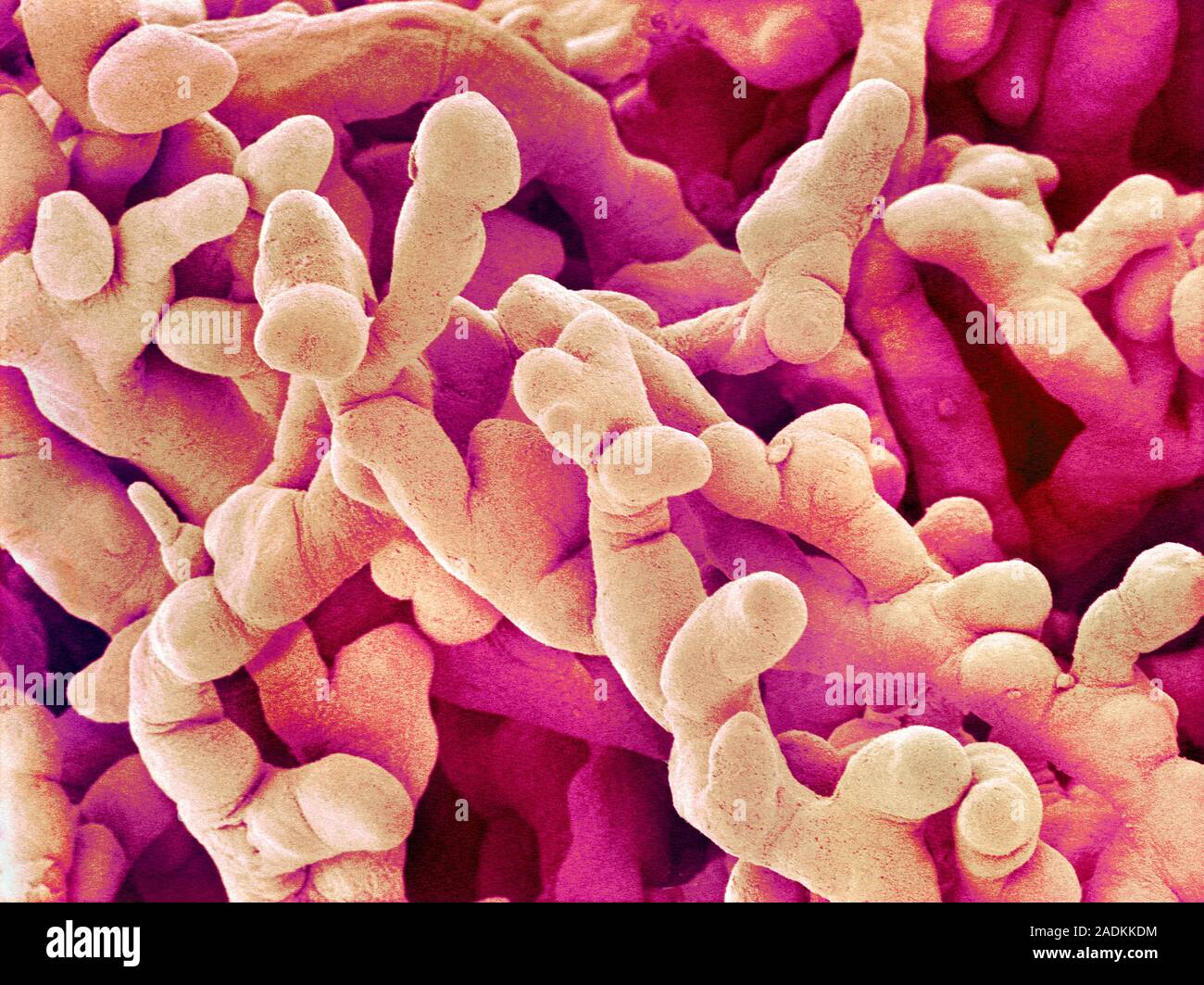 Human placenta. Coloured scanning electron micrograph (SEM) of villi in ...