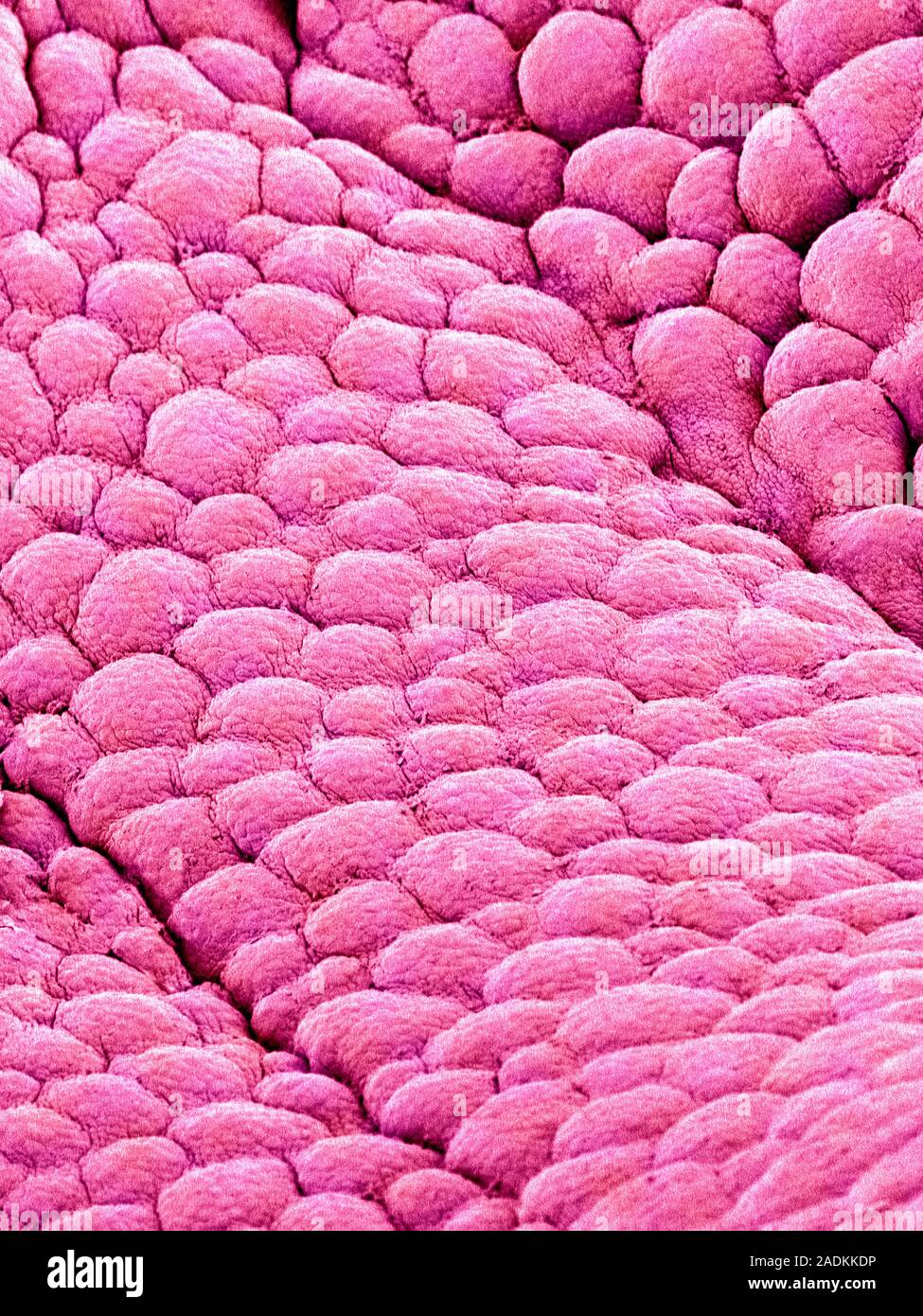 Internal wall of uterus. Coloured scanning electron micrograph of the ...