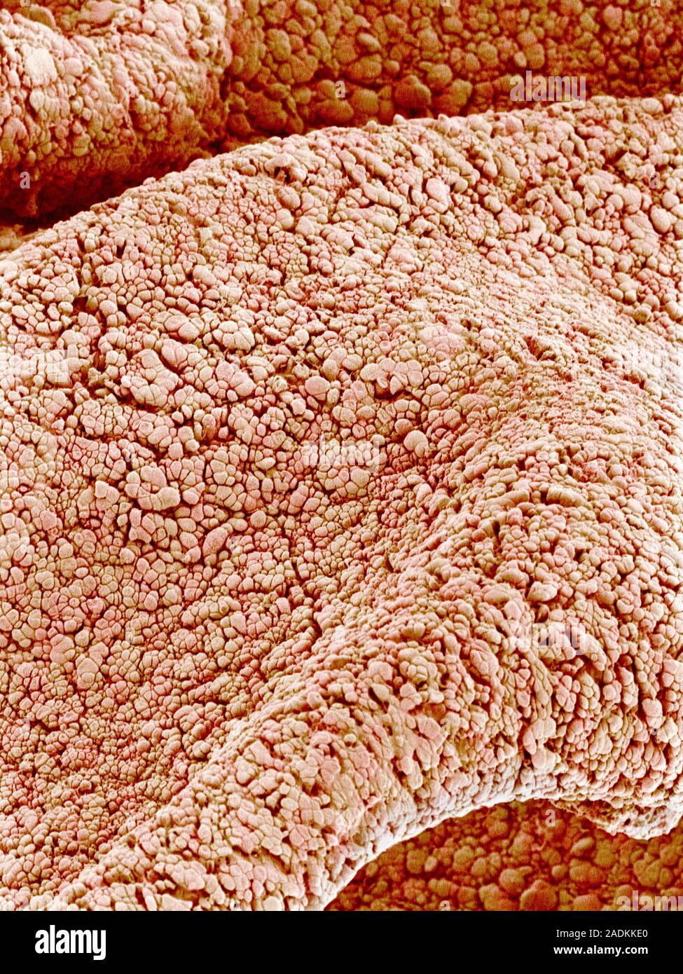 Surface of amnion. Scanning electron micrograph (SEM) of the epithelium ...