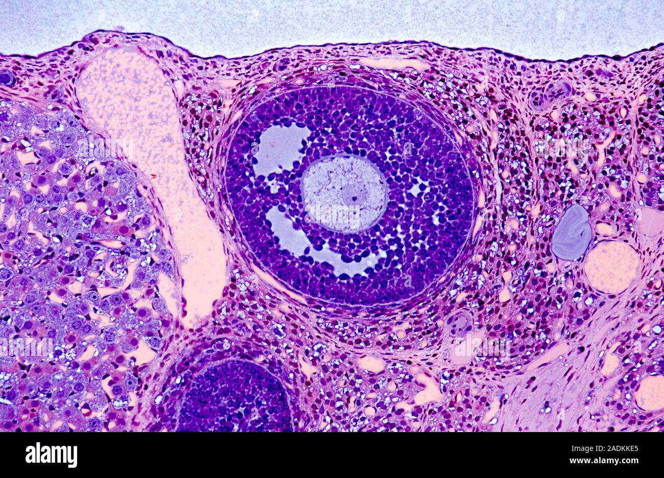 Ovarian follicle. Light micrograph of an ovarian follicle (round ...