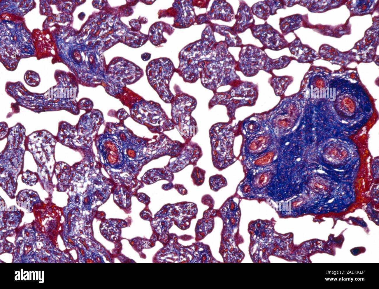 Placenta. Coloured light micrograph of a section through placental ...