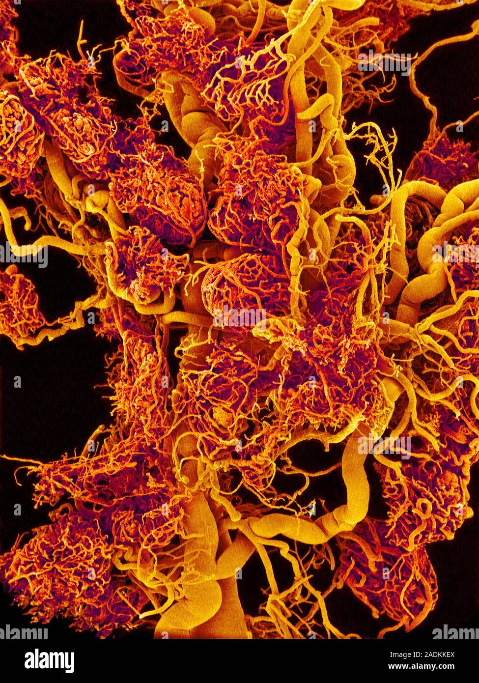 Blood vessels in the ovary of a female frog, coloured scanning electron ...