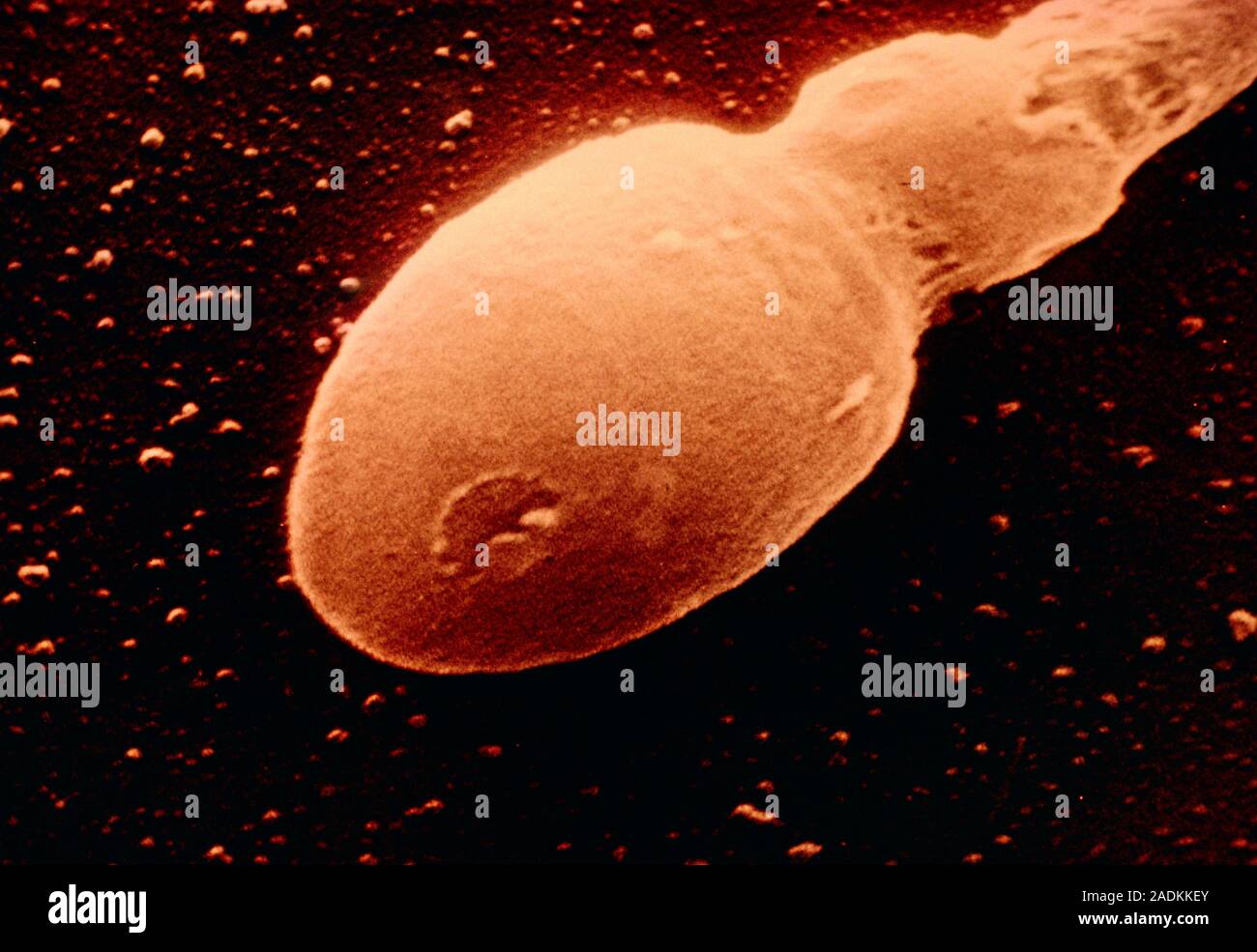 Scanning electron micrograph (SEM) of the head of a human sperm. Magnification: X 25,000 for ...