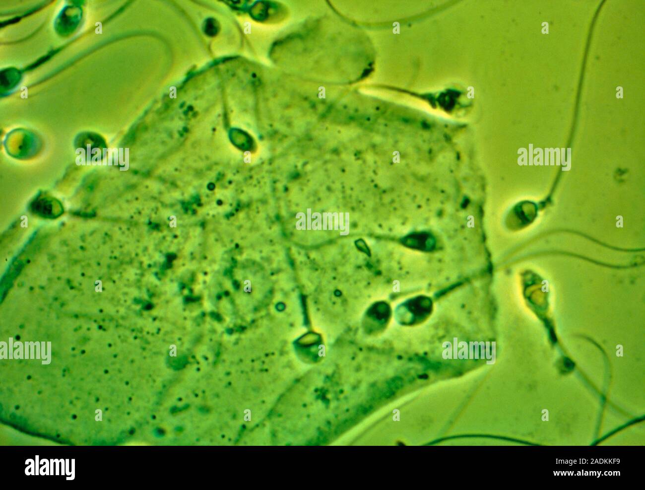 Light micrograph of human sperm surounded by nucleus to give example of ...
