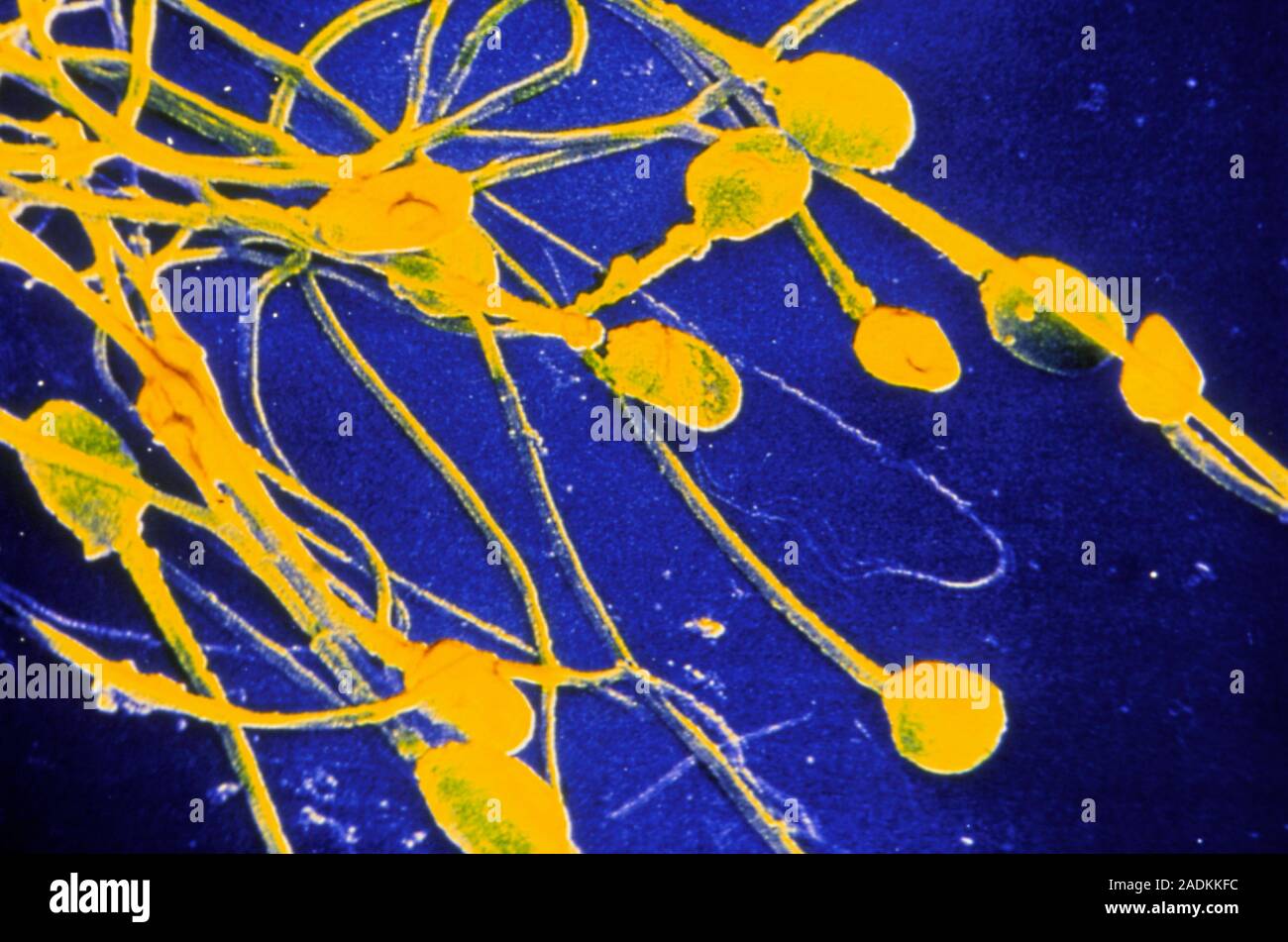 False-colour scanning electron micrograph (SEM) of a group of human ...