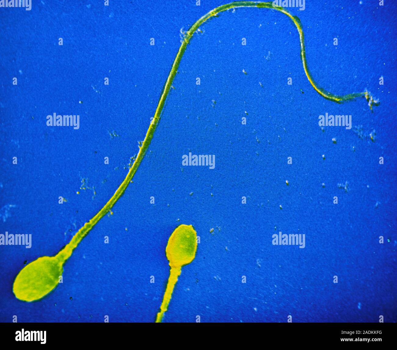 Coloured Scanning Electron Micrograph of 2 human spermatozoa, showing ...