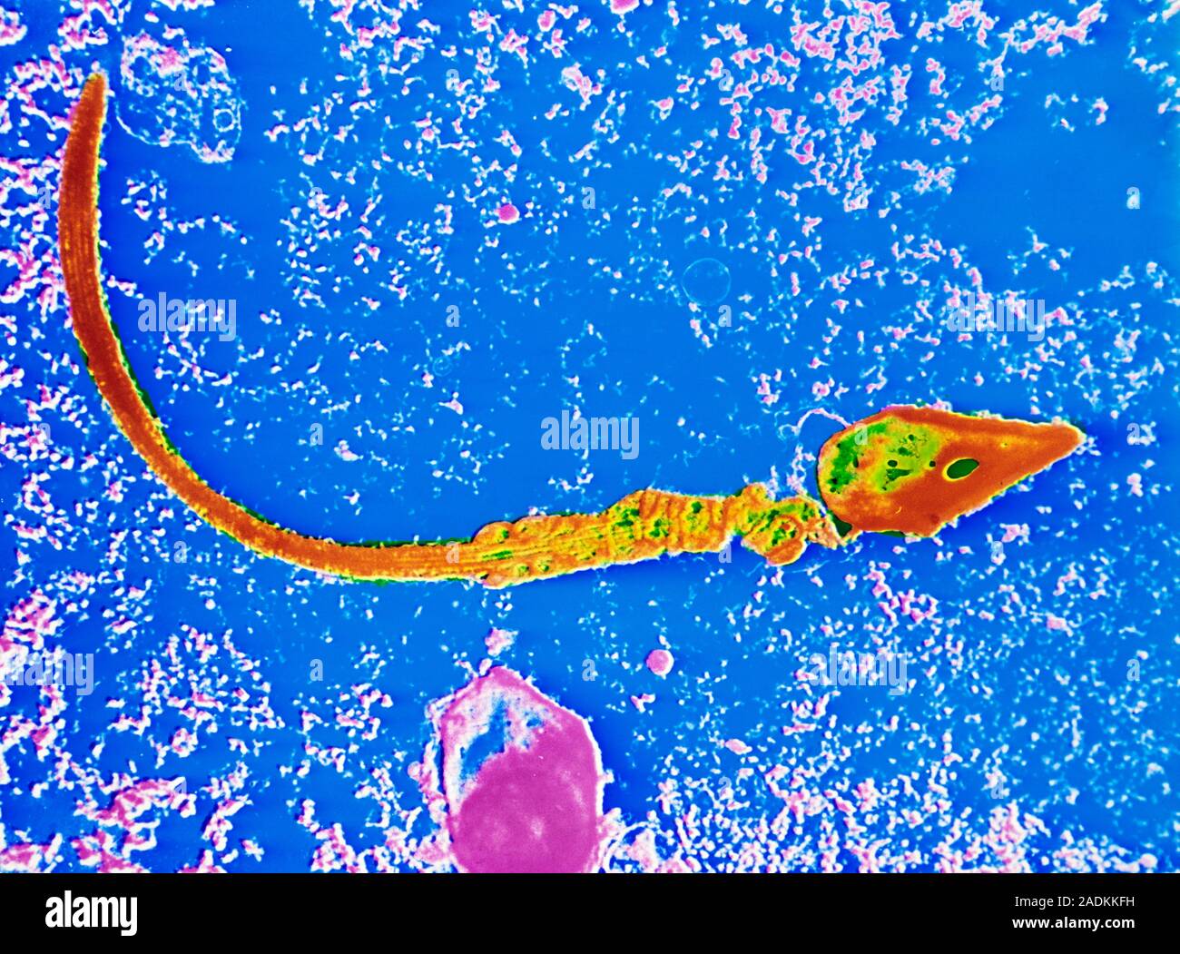 False-colour scanning electron micrograph (SEM) of a single human ...