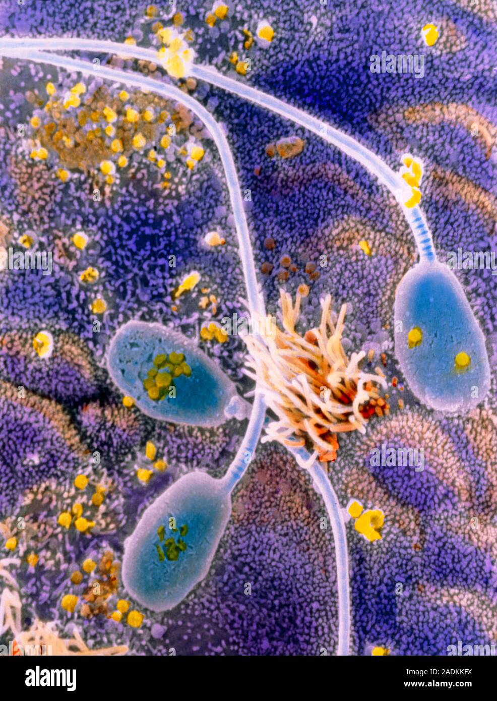 False-colour scanning electron micrograph of human sperm migrating up ...