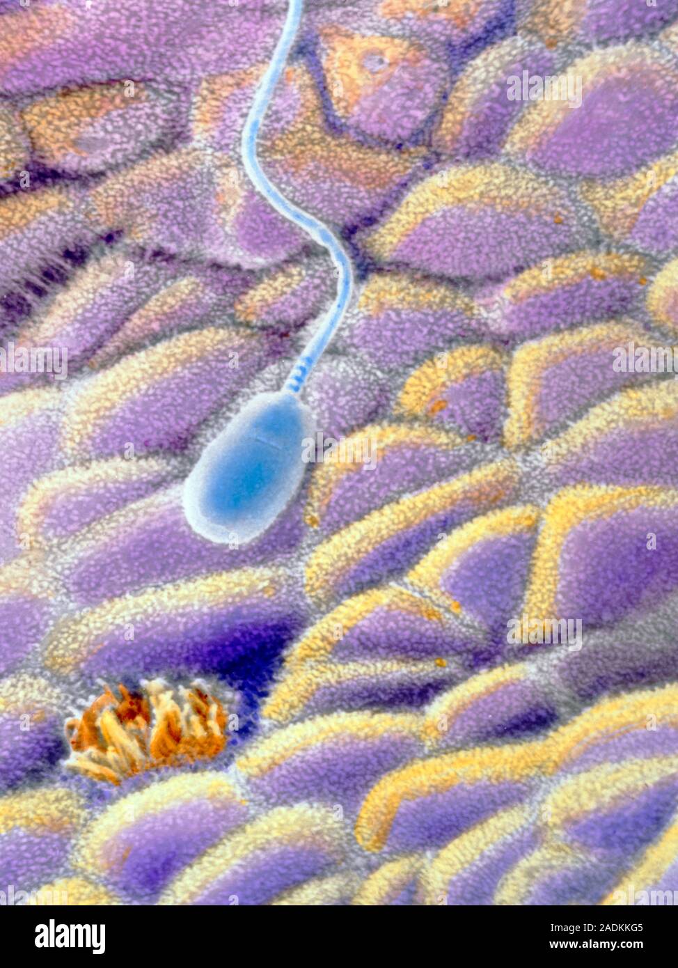 A spermatozoon on the uterine mucosa. False-colour scanning electron ...