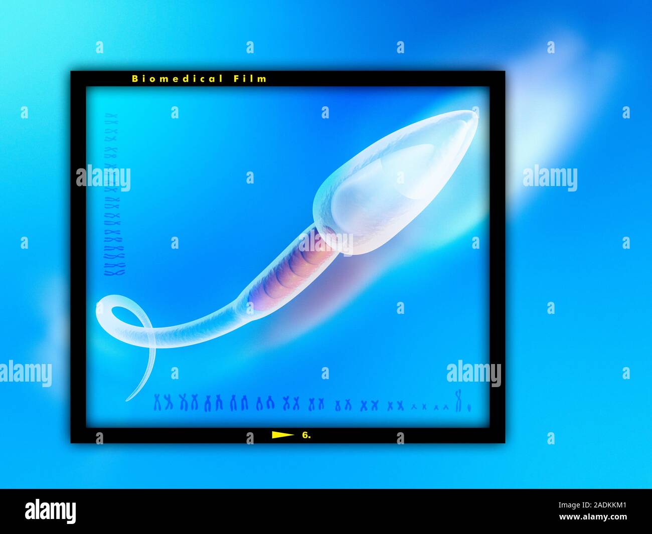 Sperm cell in frame with chromosomes, computer artwork. Chromosomes ...
