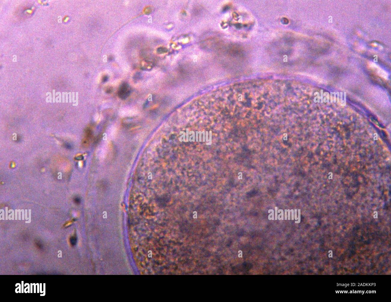 Light micrograph of a human ovum, showing the egg surrounded by its protective glycoprotein ...