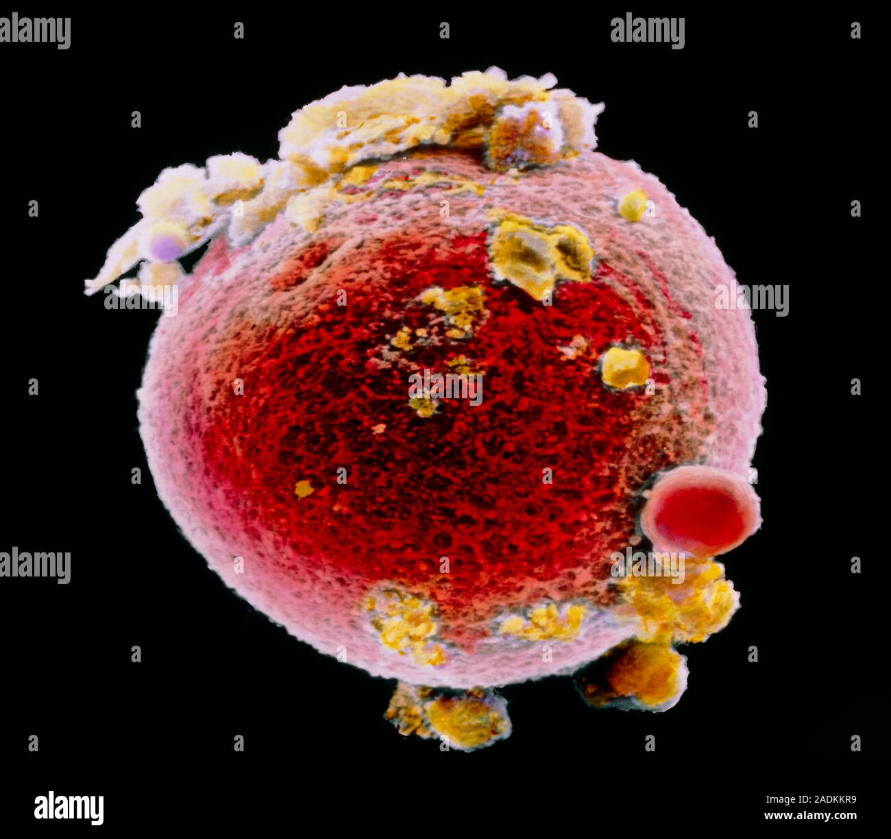 In vitro fertilisation (IVF): ovum post ovulation. False-colour ...