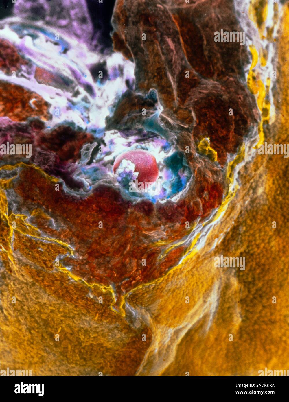 Ovulation: false-colour scanning electron micrograph showing the ...