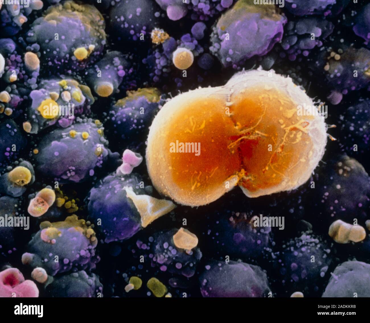 Primordial female egg cells. False-colour scanning electron micrograph ...