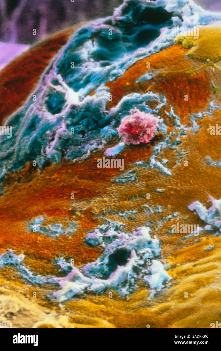 Ovary's surface at ovulation. False-colour scanning electron micrograph ...