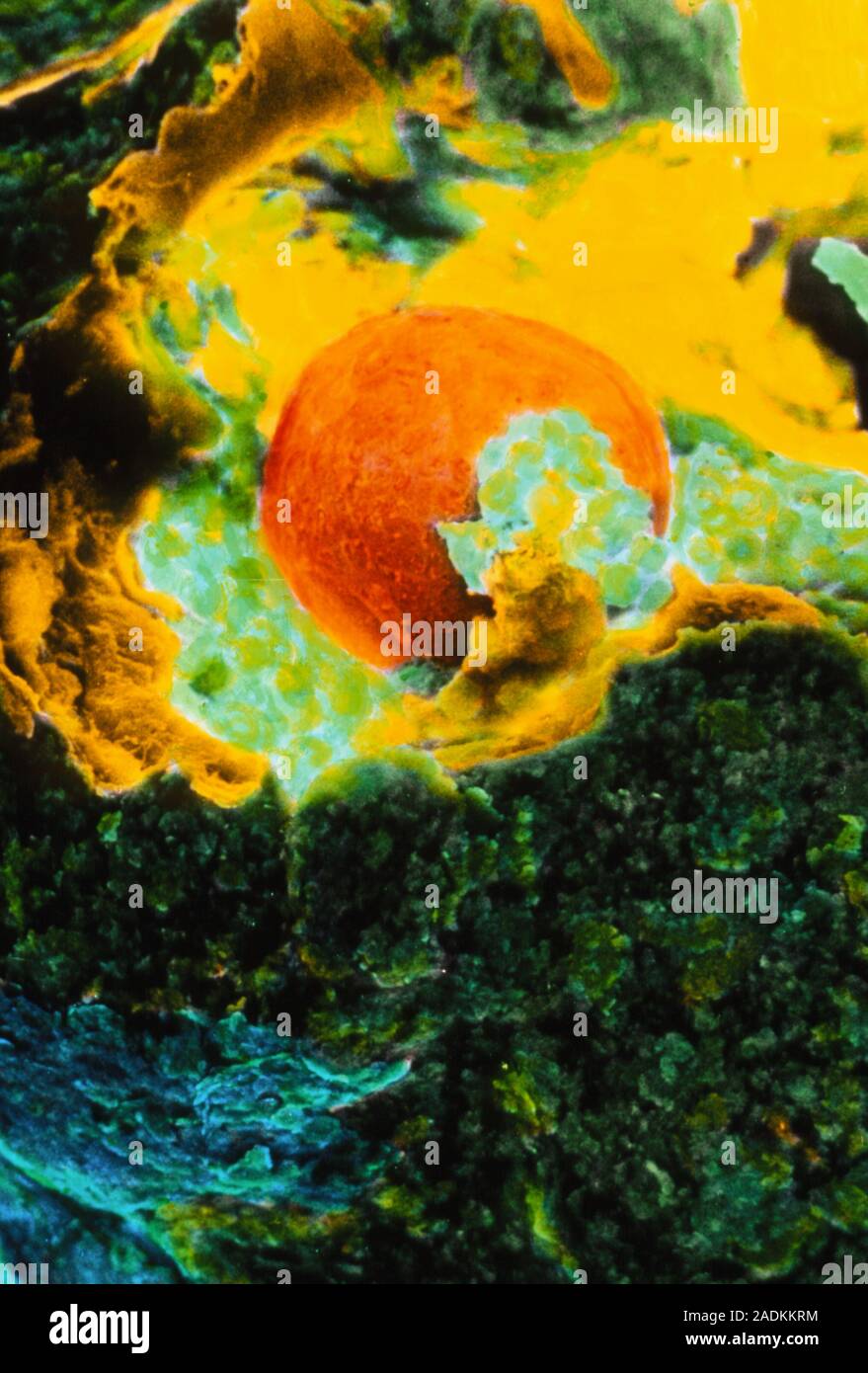 Ovulation. Coloured scanning electron micrograph of the ovulation ...