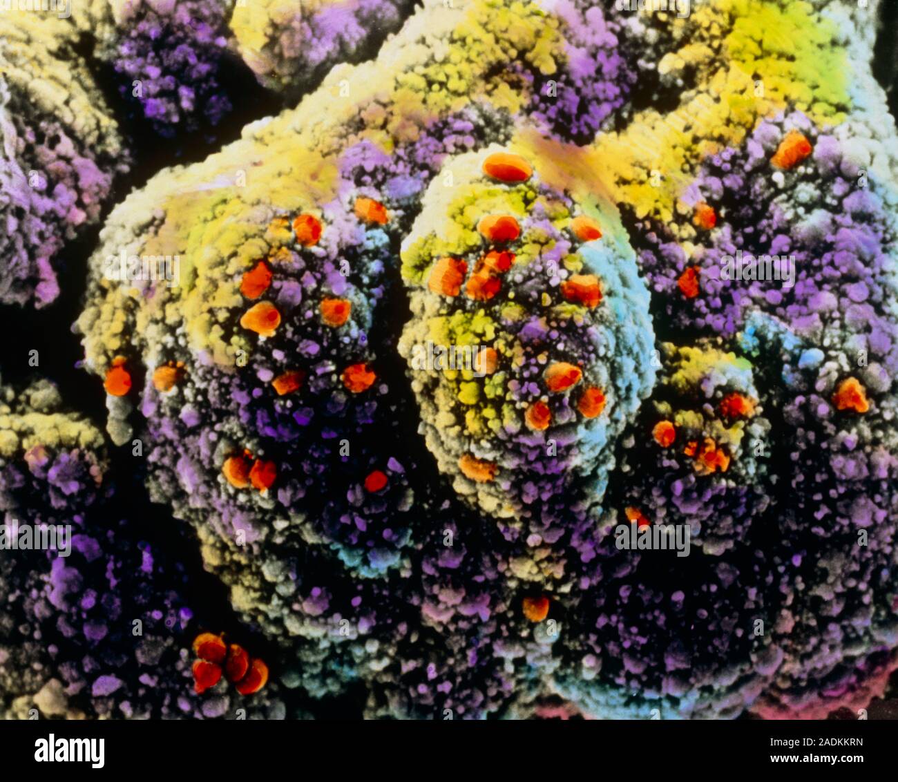 Human egg cells. Coloured scanning electron micrograph of the surface ...