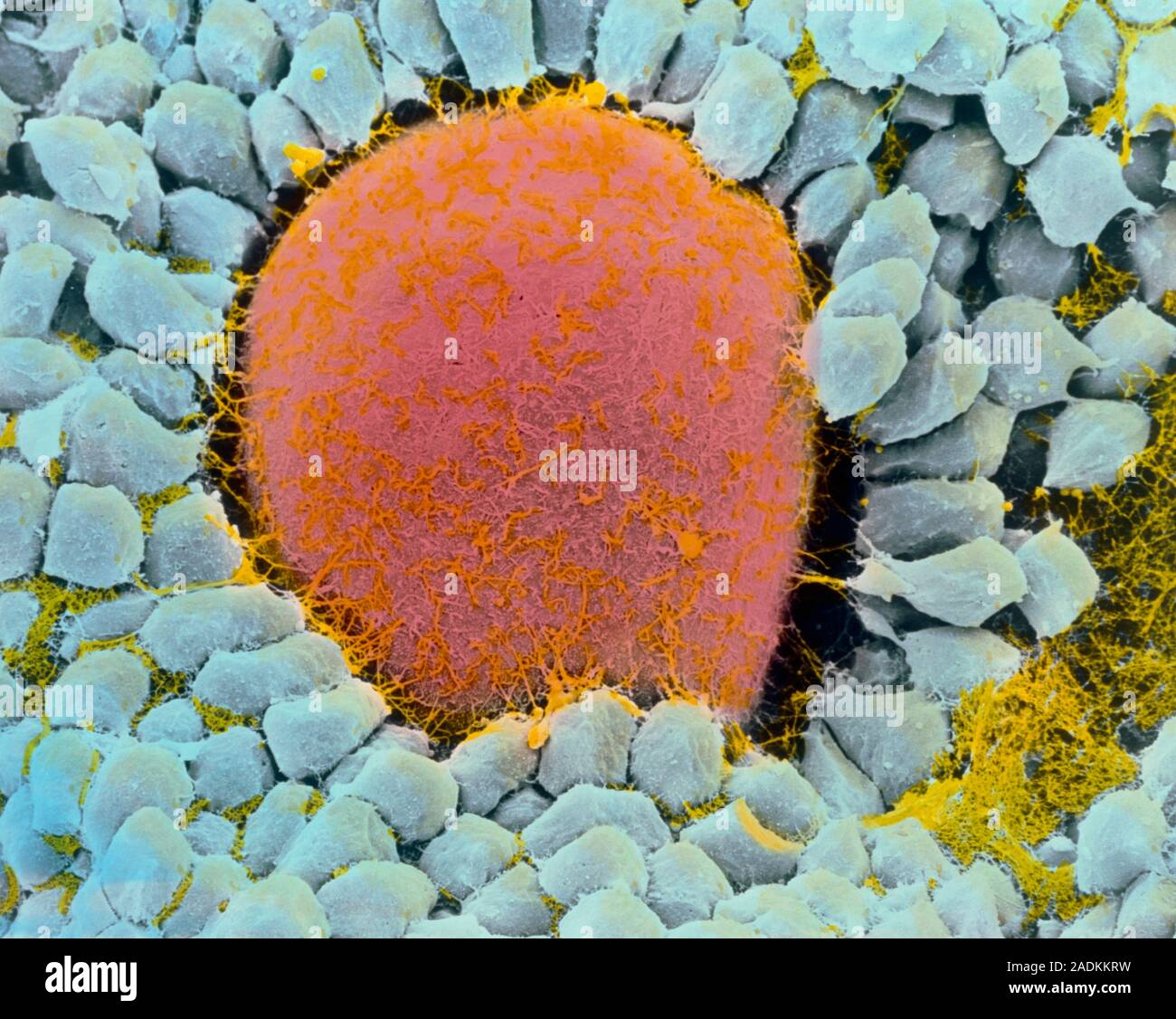 Egg cell. Coloured Scanning Electron Micrograph (SEM) of a developing ...
