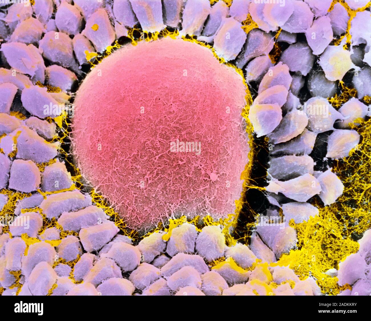 Egg cell. Coloured Scanning Electron Micrograph (SEM) of a developing ...