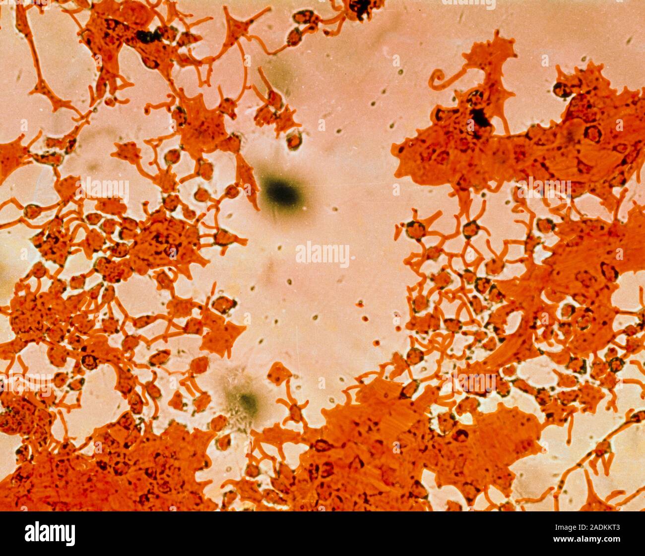 Corona radiata cells. Coloured Scanning Electron Micrograph (SEM) of ...