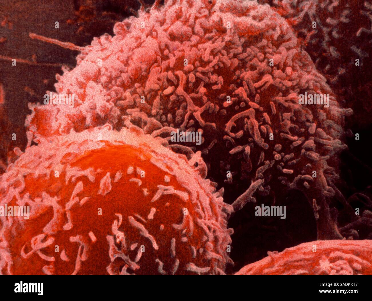 Cumulus oophorus cells. Coloured scanning electron micrograph (SEM) of ...