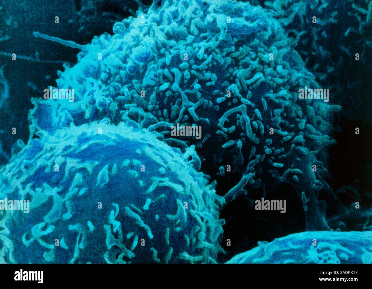 Cumulus oophorus cells. Coloured scanning electron micrograph of the ...