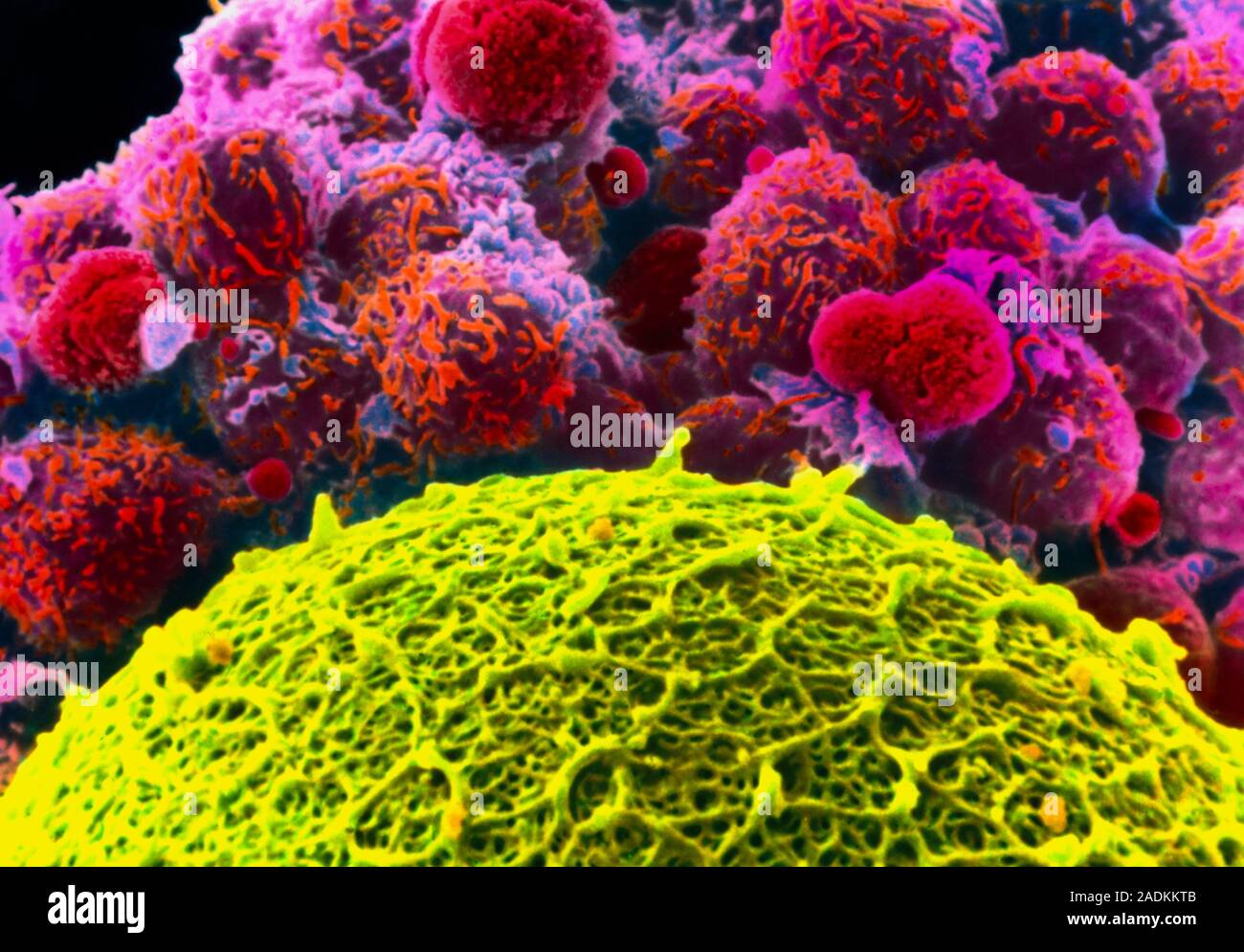 Human egg. Coloured scanning electron micrograph (SEM) of a human egg ...
