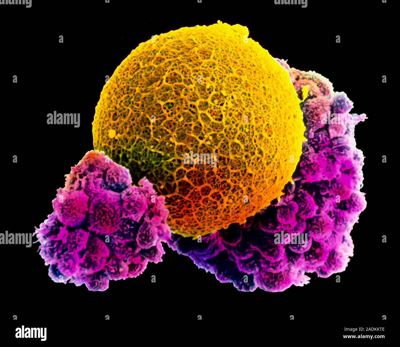 Human egg. Coloured scanning electron micrograph (SEM) of a human egg ...