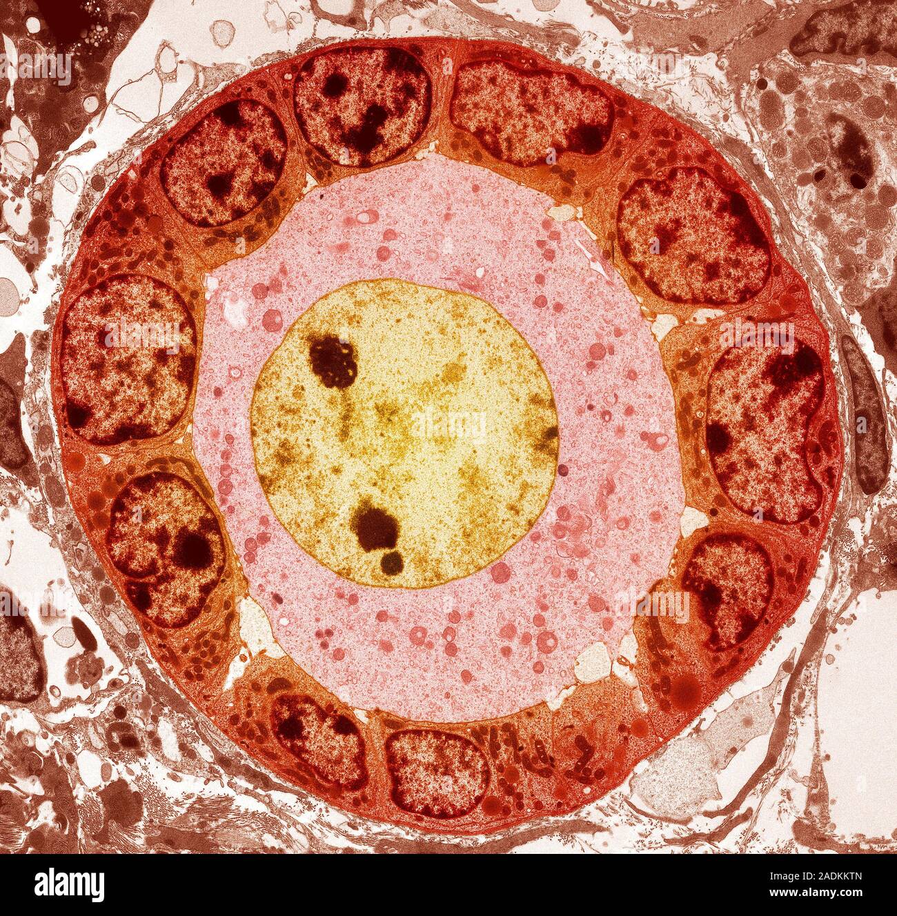 Ovarian follicle. Coloured transmission electron micrograph (TEM) of a ...