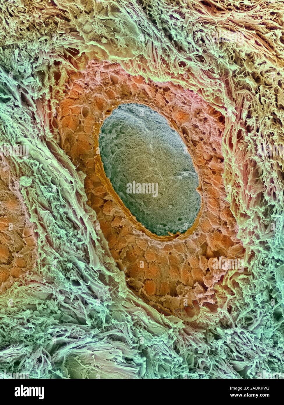 Ovarian follicle. Coloured scanning electron micrograph (SEM) of a ...