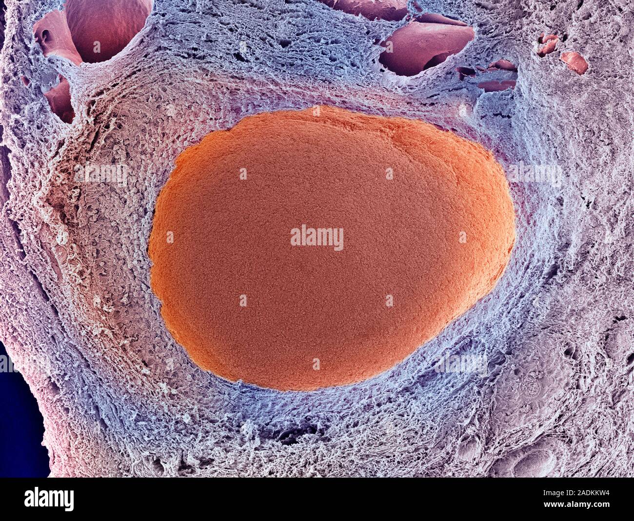 Ovarian follicle. Coloured scanning electron micrograph (SEM) of a ...
