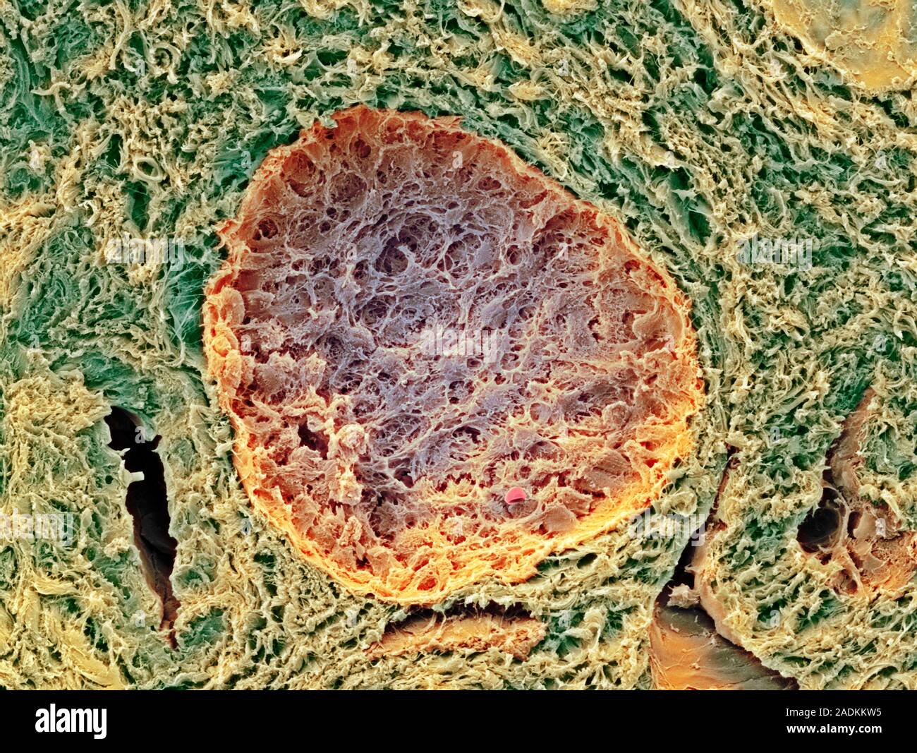 Ovarian follicle. Coloured scanning electron micrograph (SEM) of a ...