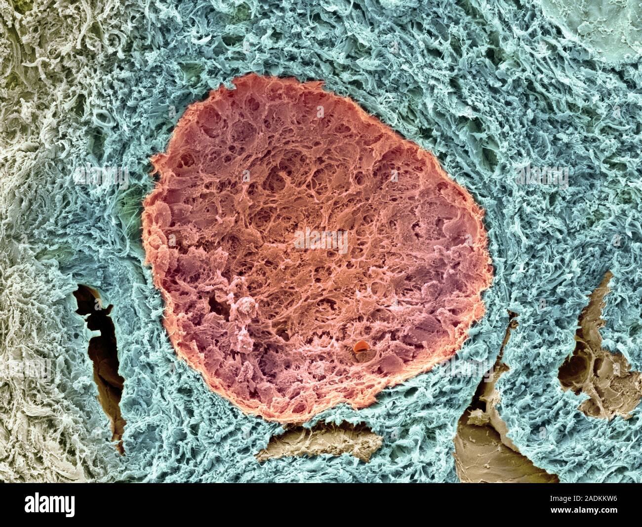 Ovarian follicle. Coloured scanning electron micrograph (SEM) of a ...