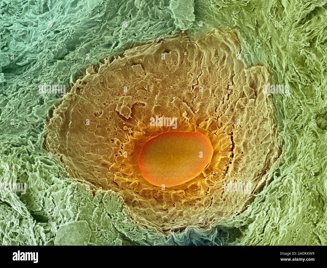 Ovarian follicle. Coloured scanning electron micrograph (SEM) of a ...