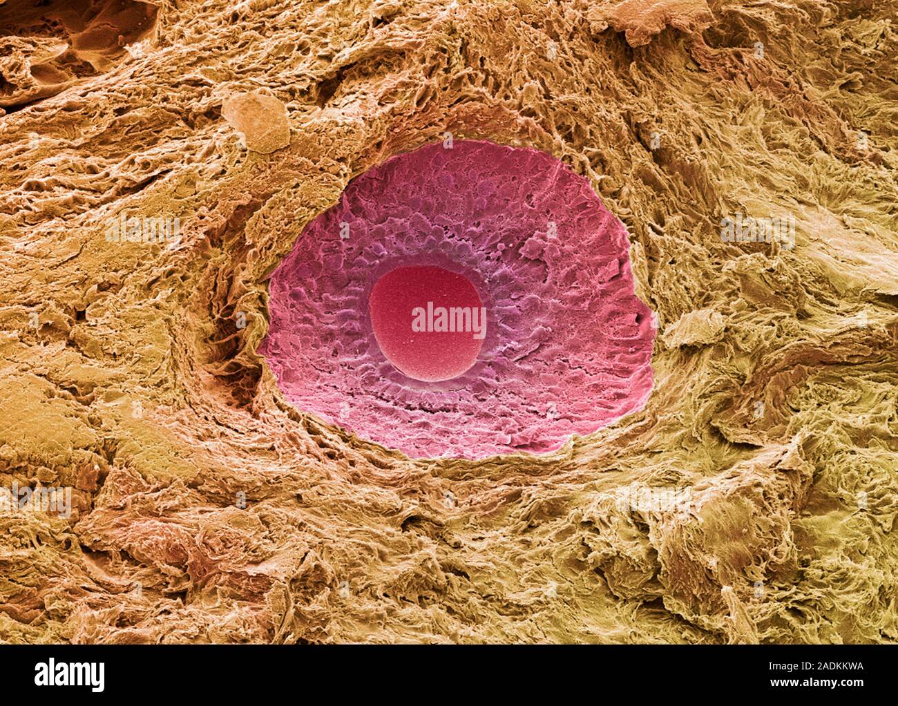 Ovarian follicle. Coloured scanning electron micrograph (SEM) of a ...