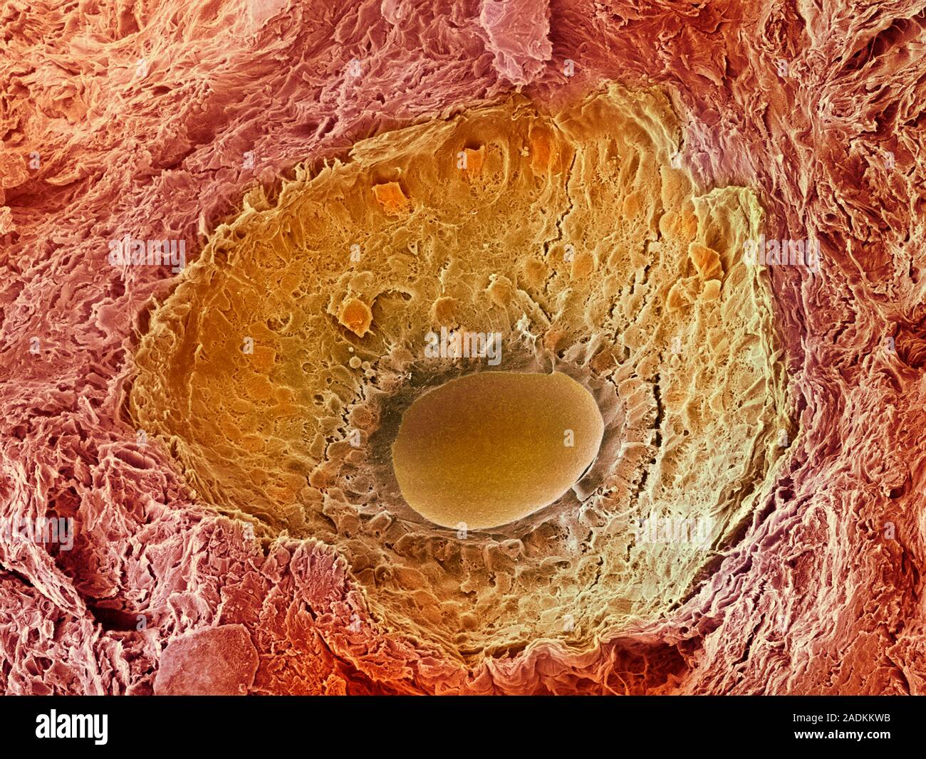 Ovarian follicle. Coloured scanning electron micrograph (SEM) of a ...