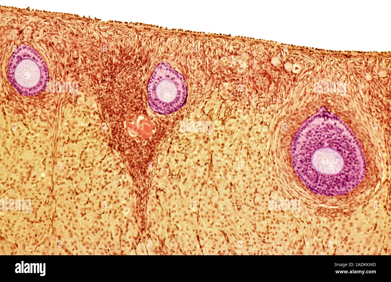 Ovarian follicles. Coloured light micrograph of a section through an ...