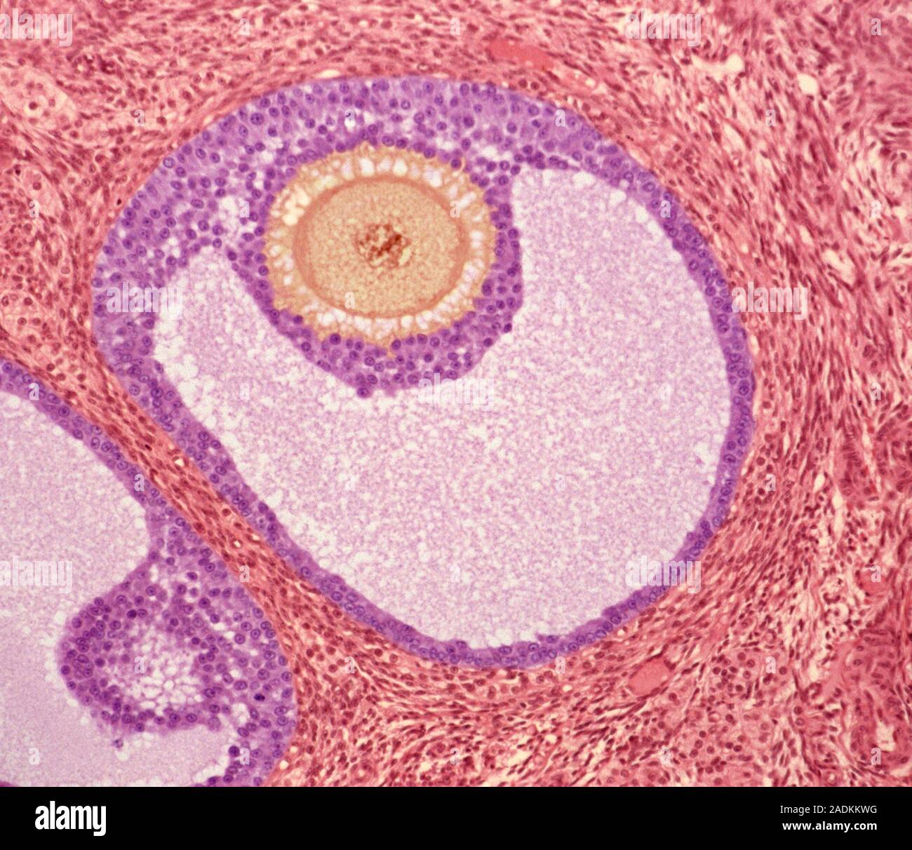 Ovarian follicle. Coloured light micrograph of a section through a ...