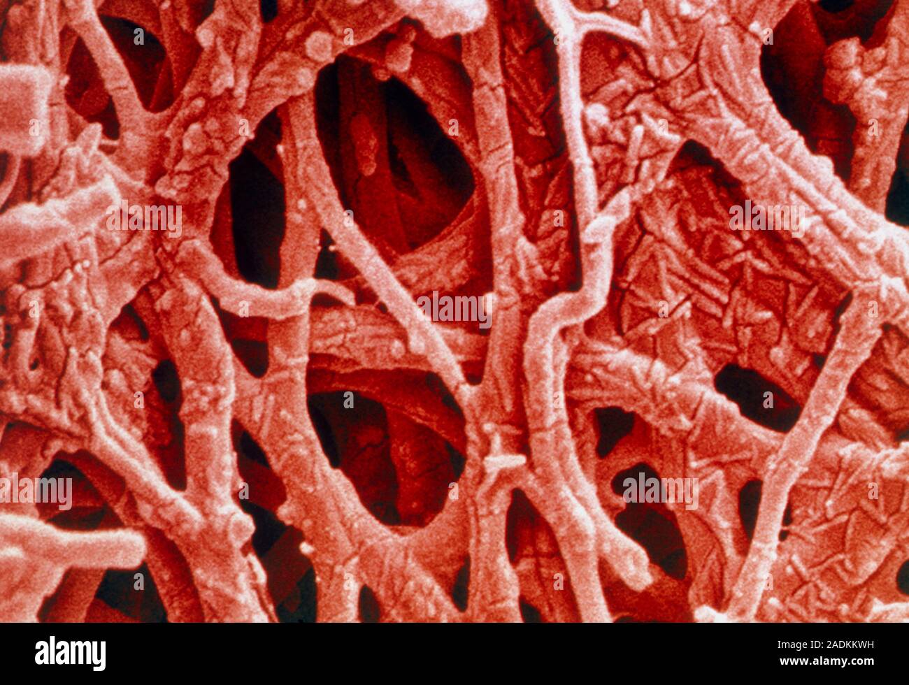 Eggshell membrane. Coloured scanning electron micrograph (SEM) of the ...