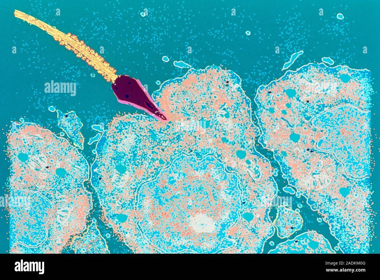 False Colour Transmission Electron Micrograph Tem Of An Early Stage Of Fertilisation Showing
