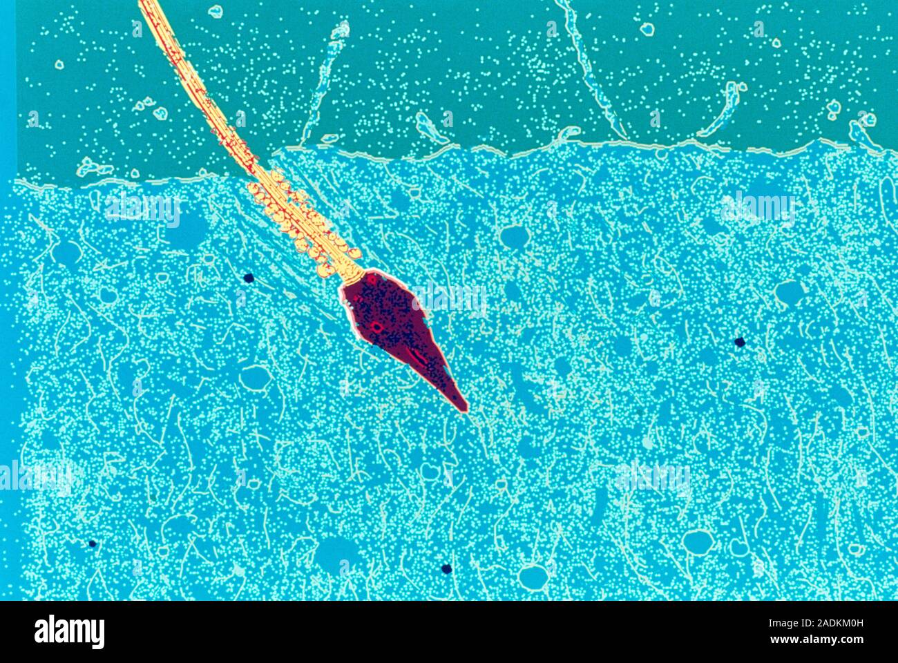 False Colour Transmission Electron Micrograph Tem Of An Egg Ovum During Fertilisation