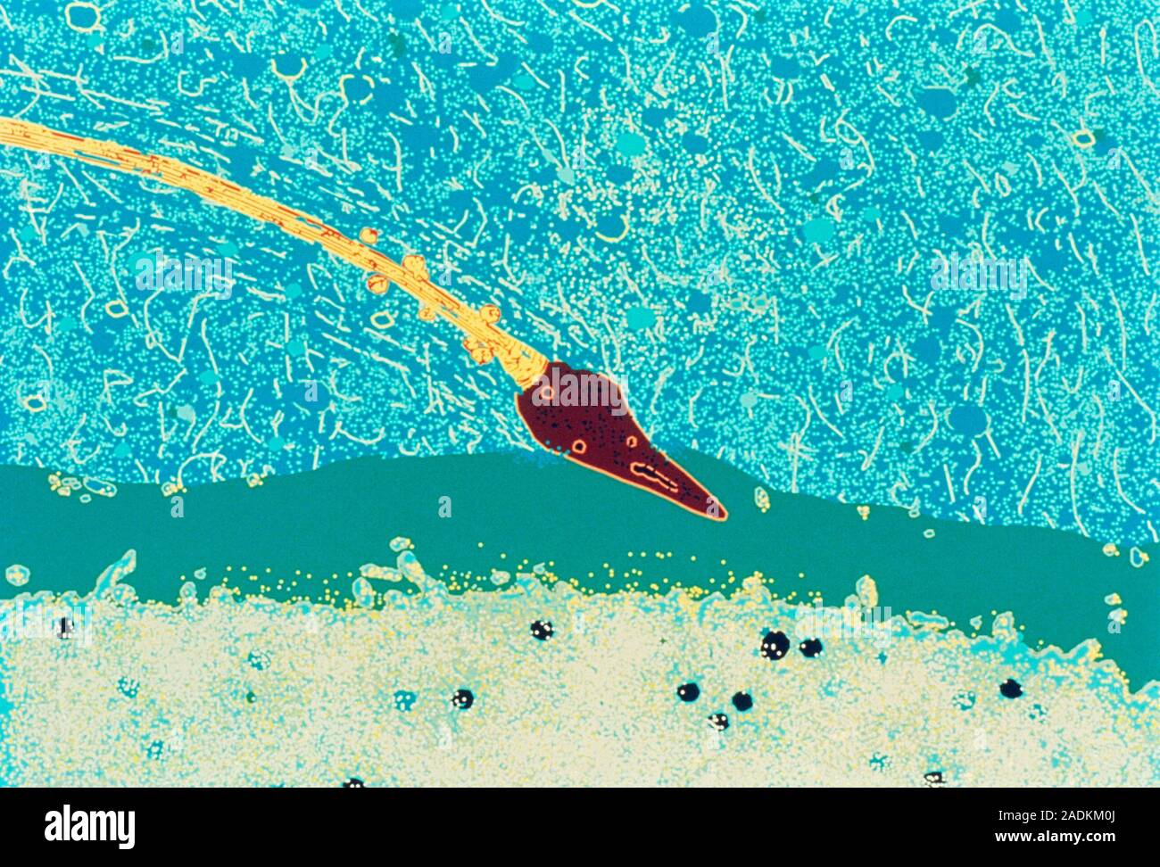 False Colour Transmission Electron Micrograph Tem Of An Egg Ovum During Fertilisation