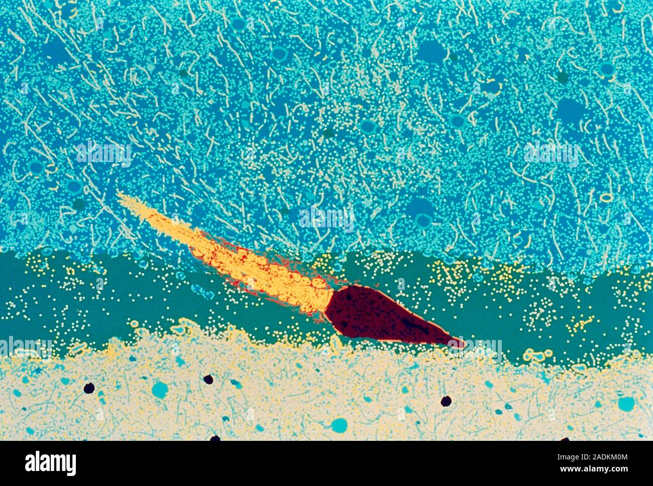 False Colour Transmission Electron Micrograph Tem Showing Penetration Of An Ovum By A Single