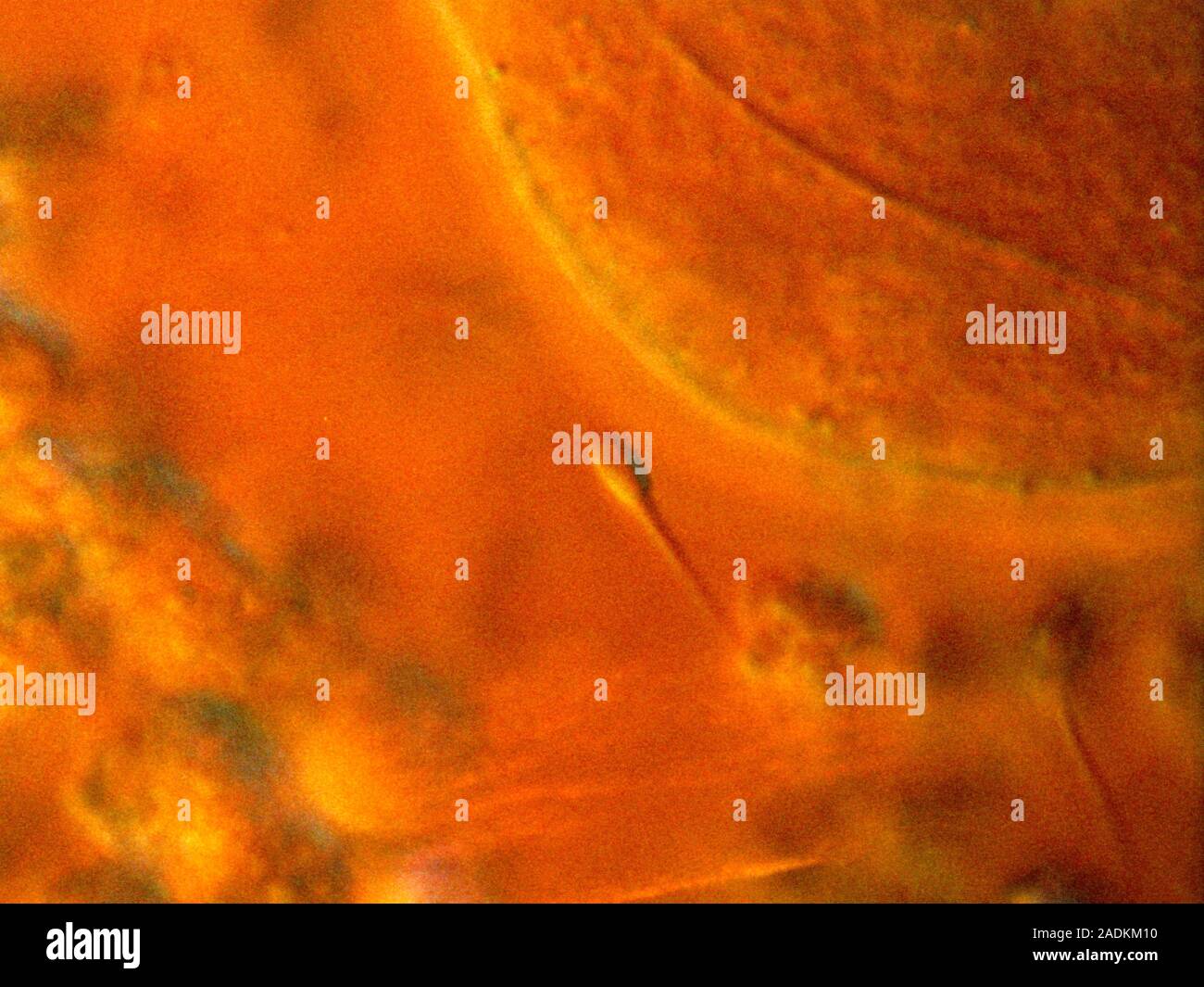 Light micrograph of the encounter between sperm and ovum during in vivo ...