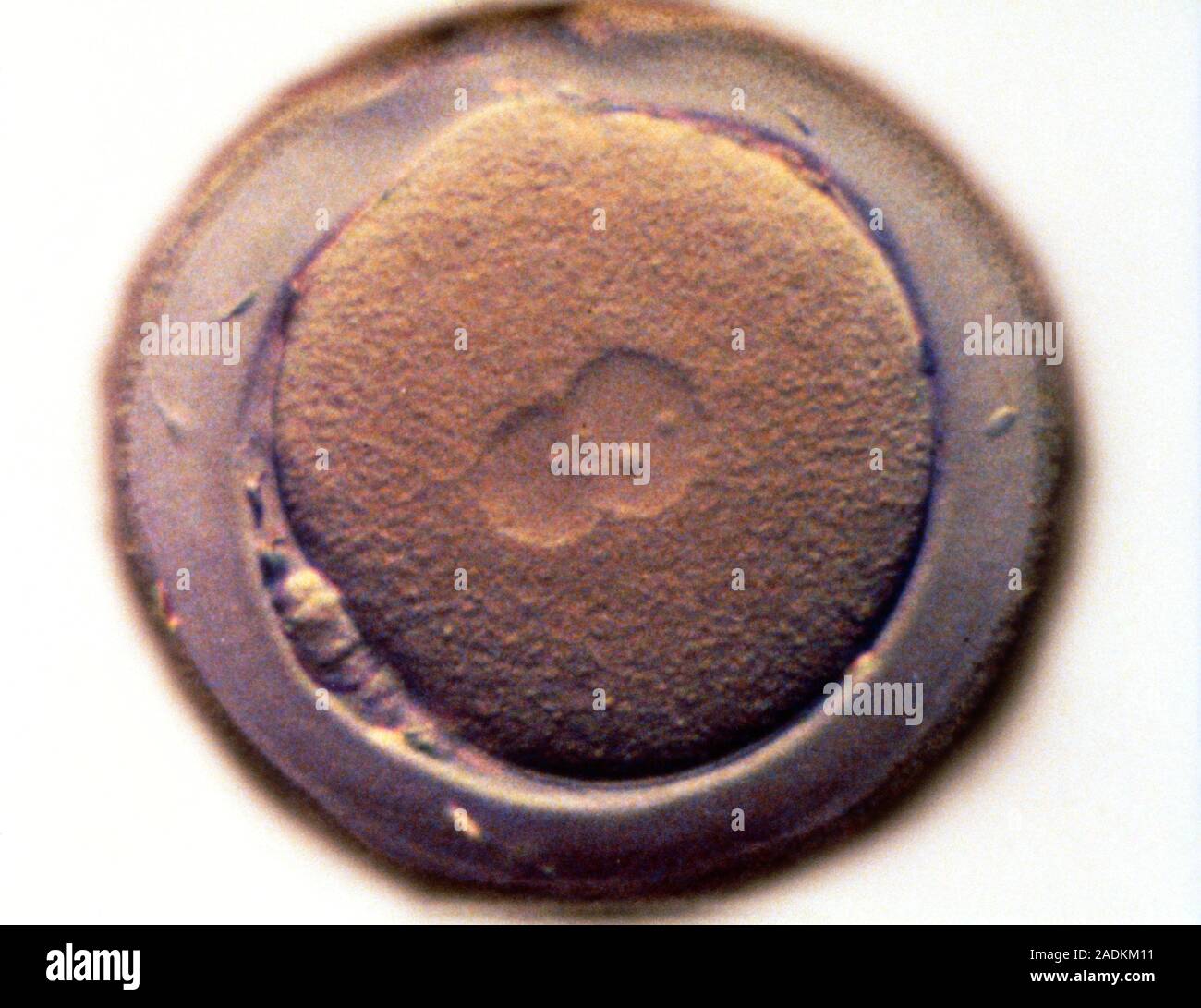 Light micrograph showing the fusion of male and female human pronuclei ...