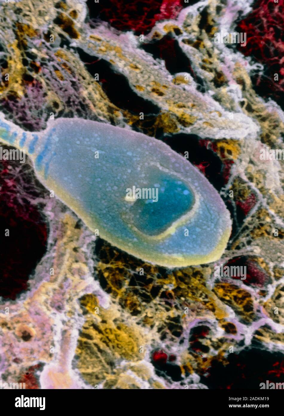 A spermatozoon on the egg's surface. False-colour scanning electron ...