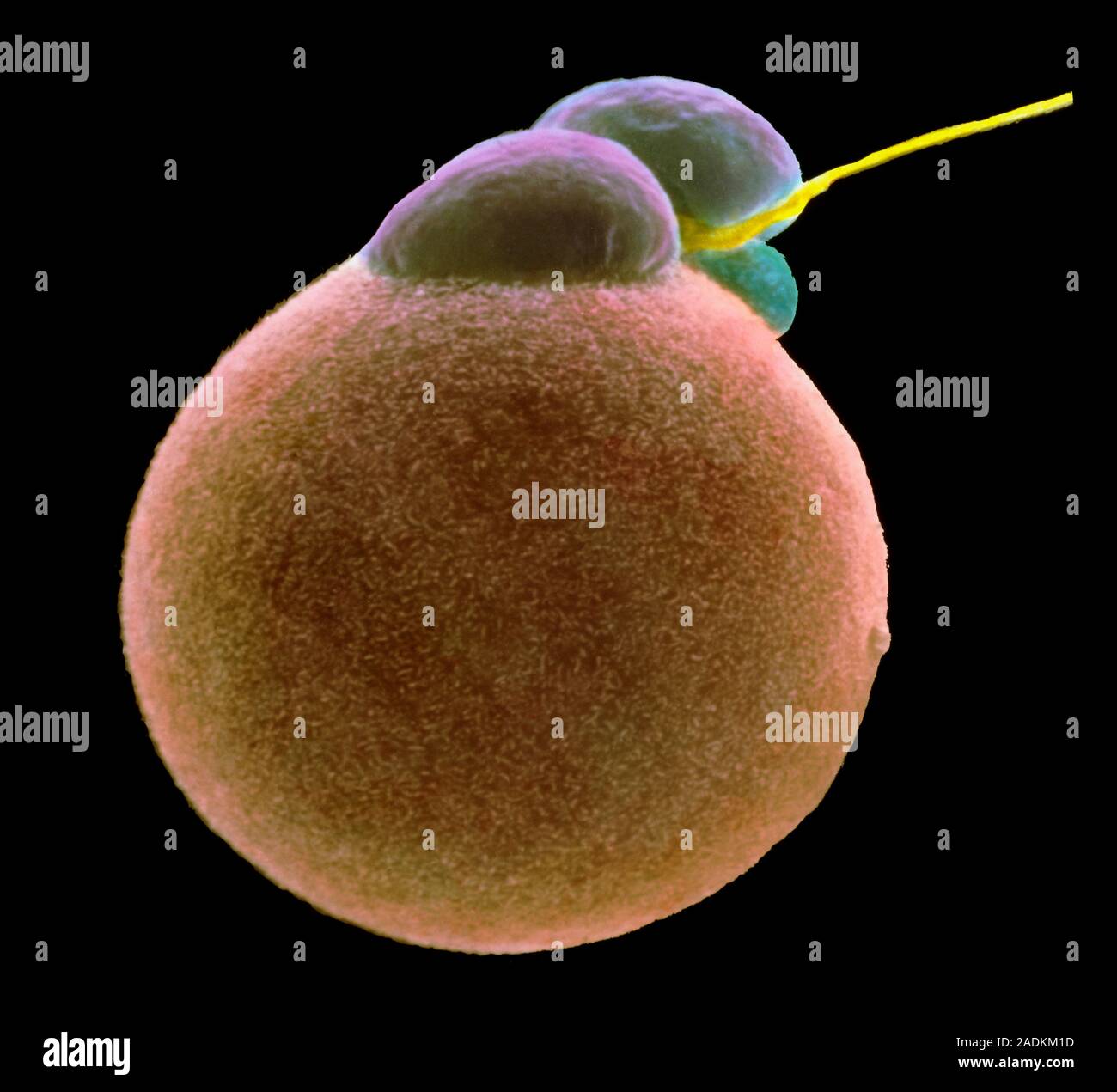 Coloured scanning electron micrograph of sperm (yellow) fertilising an ...