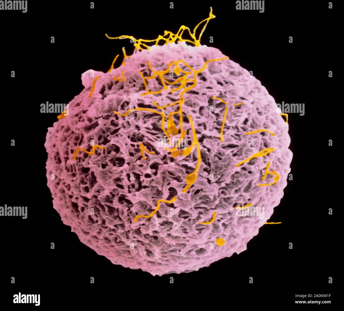 Fertilisation. Coloured Scanning Electron Micro- graph (SEM) of a human ...