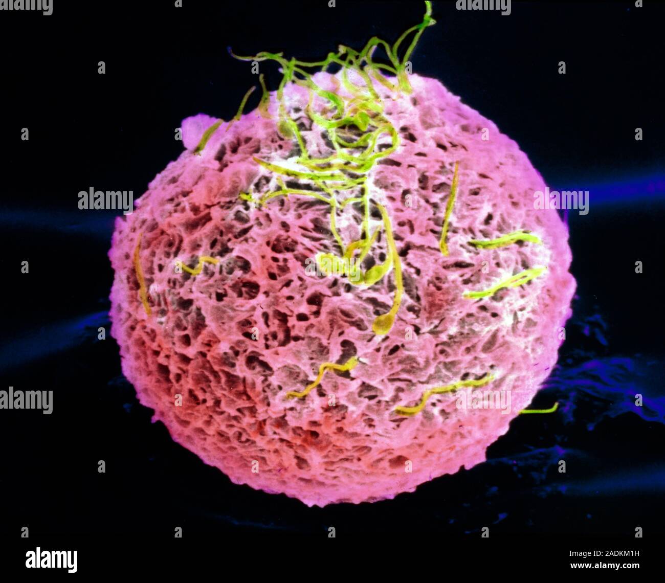 Fertilisation. Coloured scanning electron micrograph (SEM) of a human ...